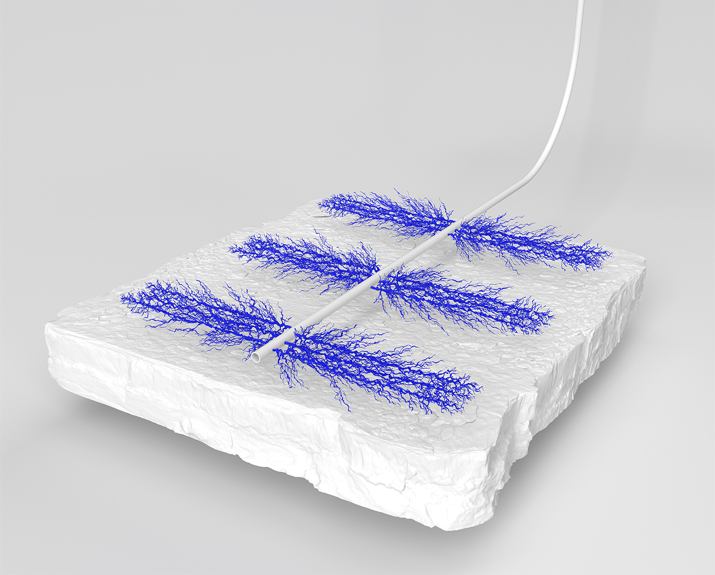 OpenPath Flex Customizable Acid Stimulation Service | SLB